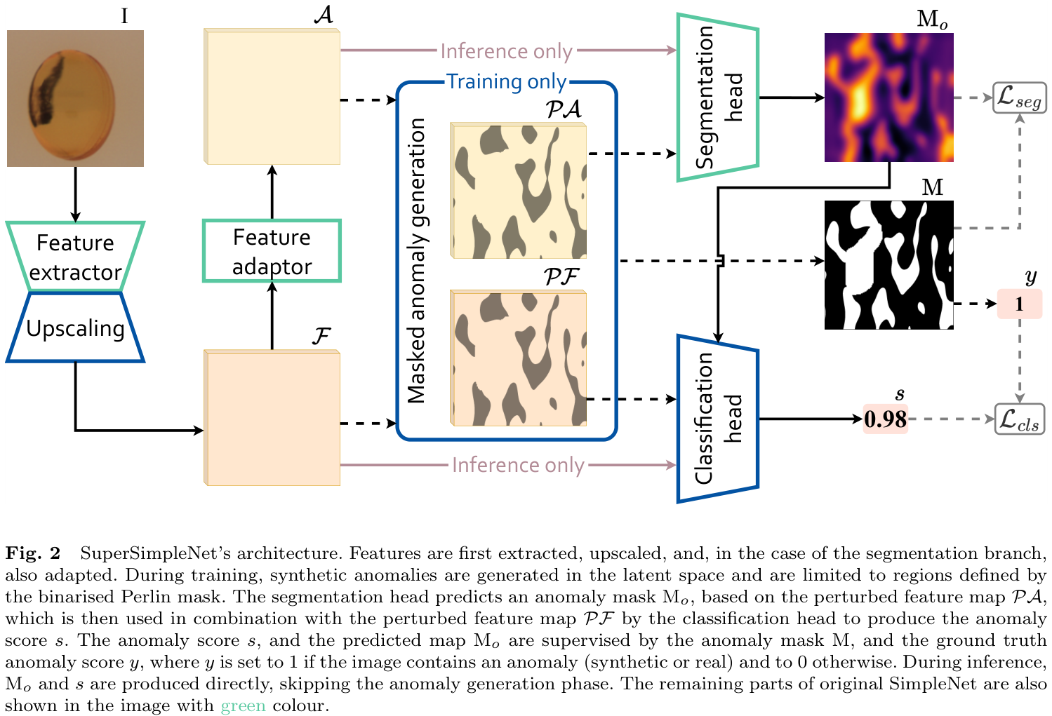 SuperSimpleNet: 不再浪费任何一张标签！首个统一所有监督范式的表面缺陷检测模型 - 知乎