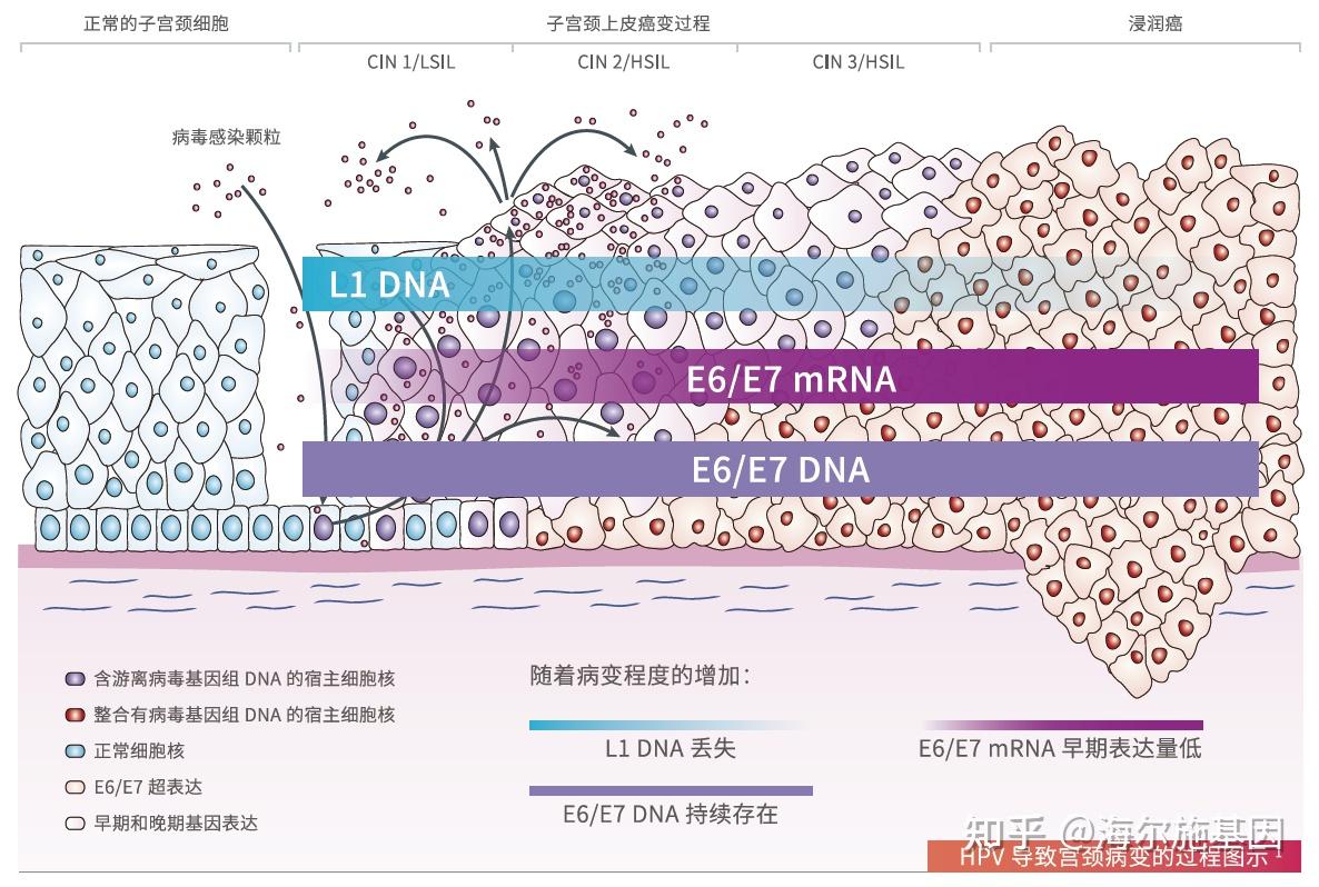 玩转Sanger测序仪丨专题五：HPV E6/E7 DNA 全分型核酸检测 - 知乎