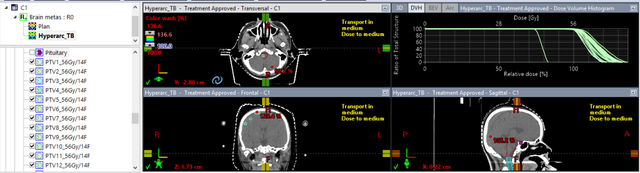 100万脑转移瘤救星【HyperArc超弧刀】——无创治疗颅内肿瘤 - 知乎
