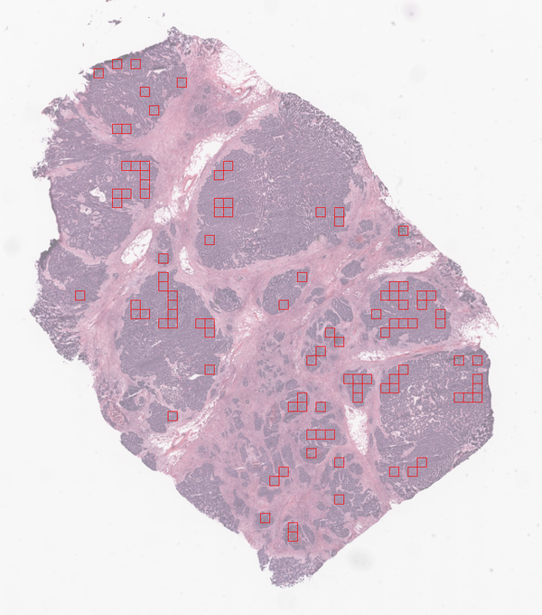 病理图像处理随笔(2)--WSI切片 - 知乎