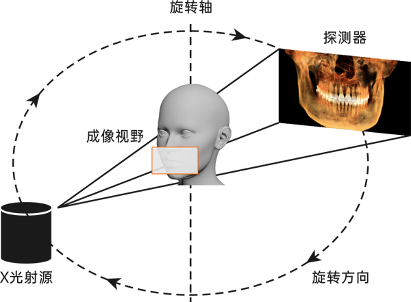 一文读懂 | 口腔CBCT的前世今生 - 知乎