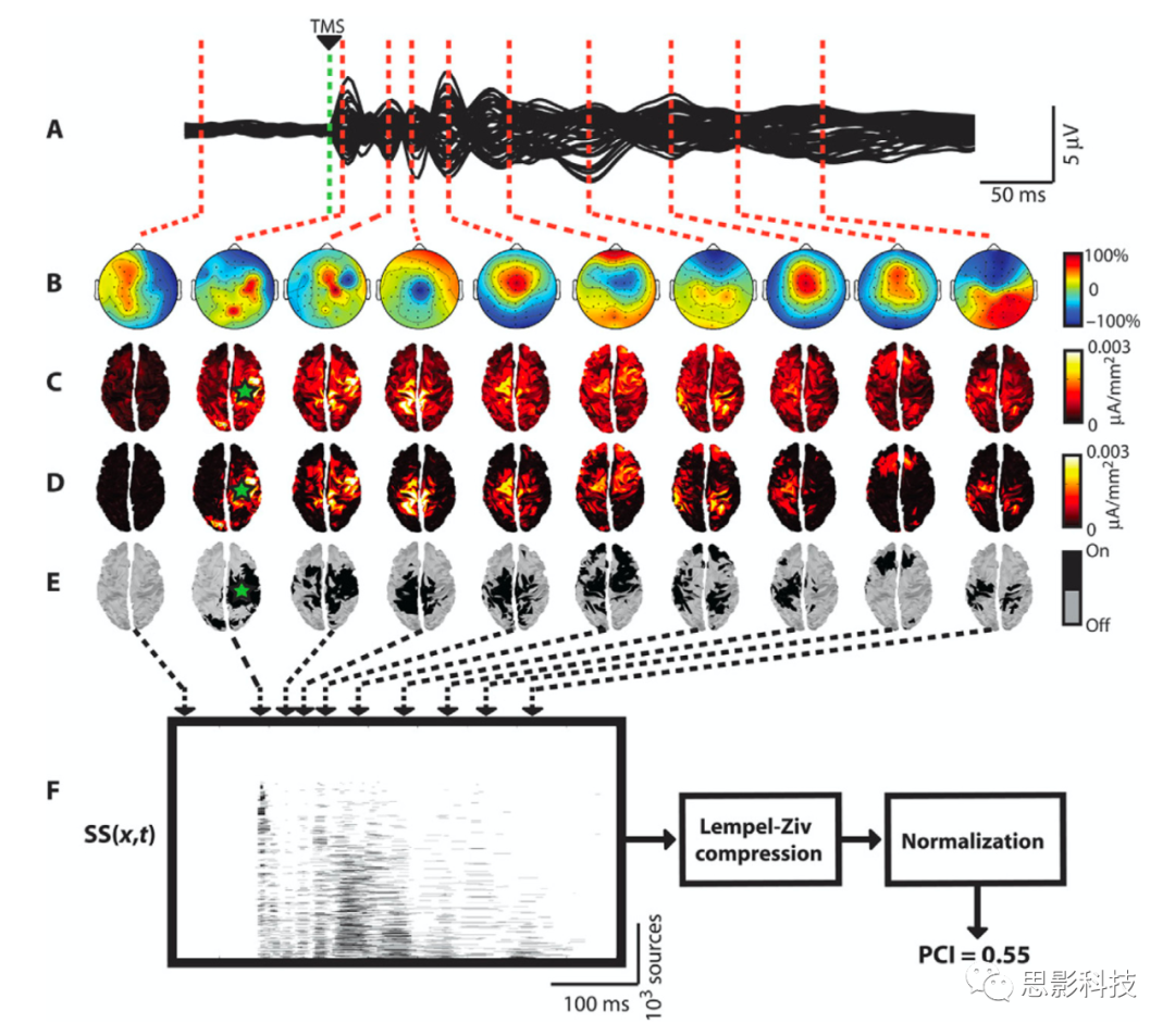 TMS-EEG的临床应用及展望 - 知乎
