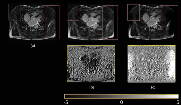 DAGAN: DAGAN for Fast CS-MRI Reconstruction - 知乎