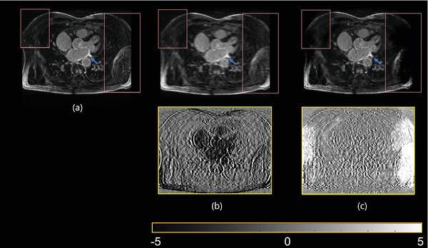 DAGAN: DAGAN for Fast CS-MRI Reconstruction - 知乎