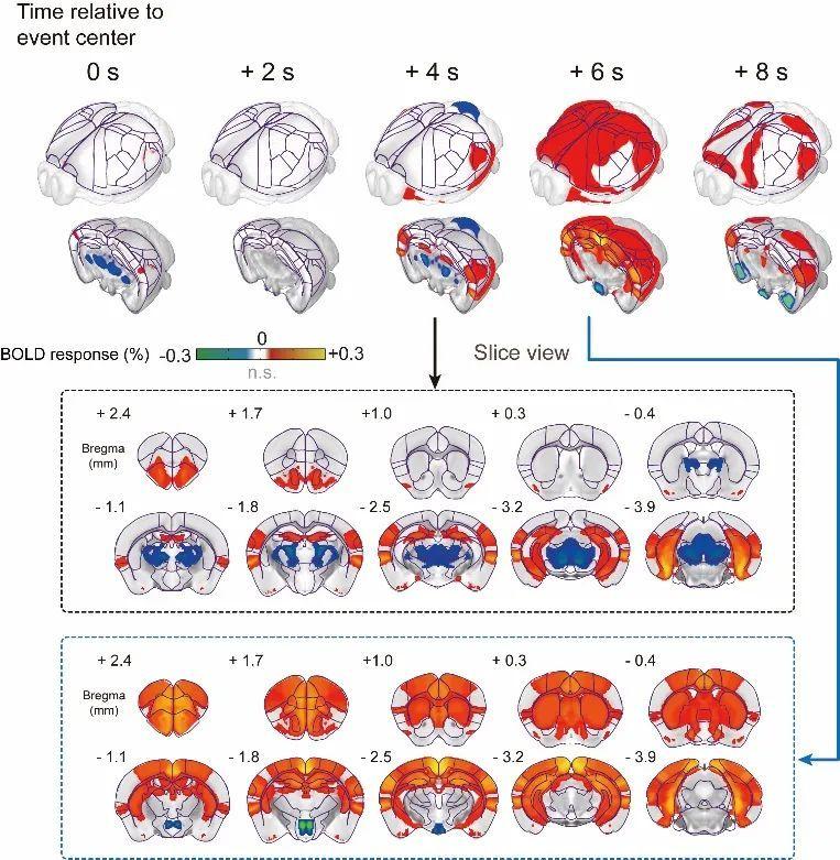 Nature子刊：梁智锋组建立了同时电生理记录的小鼠睡眠fMRI的方法 - 知乎