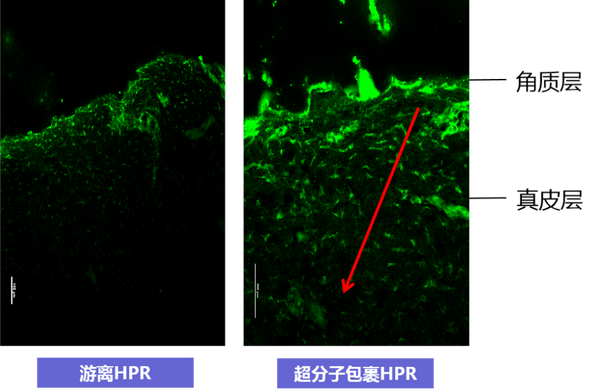 超分子技术真皮层靶向递送HPR的液体面霜，5倍真皮含量，实现精准护肤 - 知乎