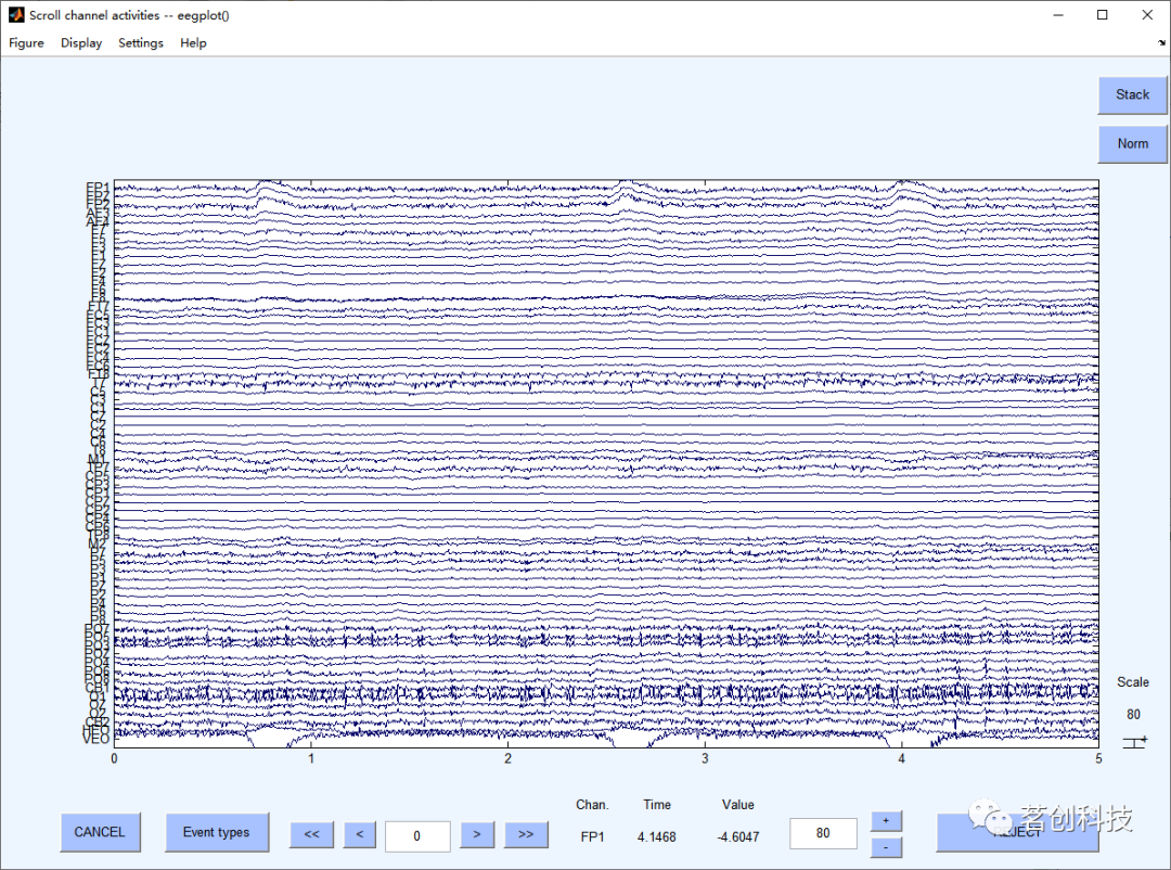 eeglab脑电数据预处理：step by step - 知乎