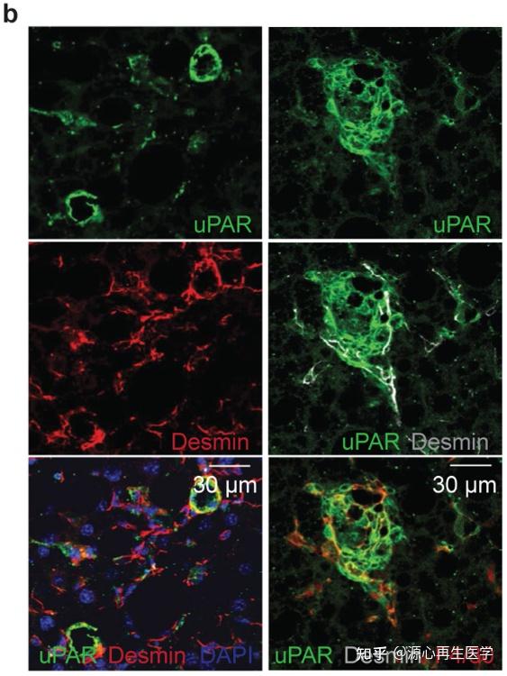 Nature丨“返老还童”新突破：uPAR助力CAR-T提高抗衰老效果 - 知乎