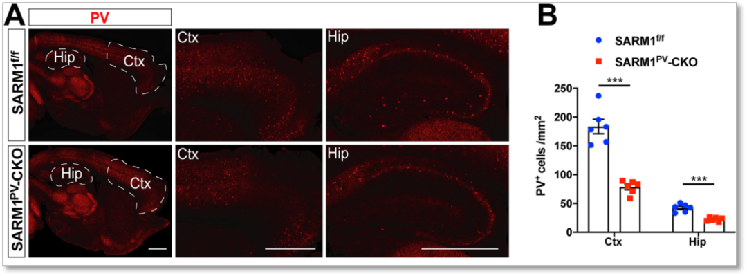 Cell DeathDis｜杭州师范大学黄智慧/温州医科大学汪伟团队发现SARM1蛋白在自闭症谱系障碍发病中的新机制 - 知乎