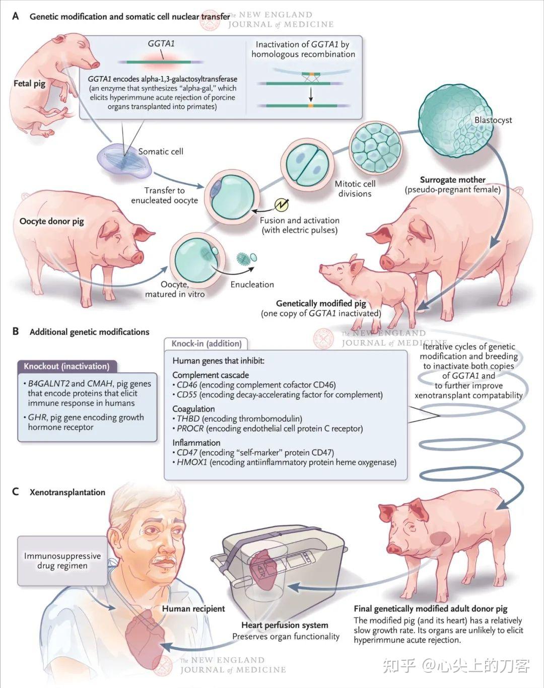 NEJM发表猪心移植病例，非典型排斥迷雾重重 - 知乎
