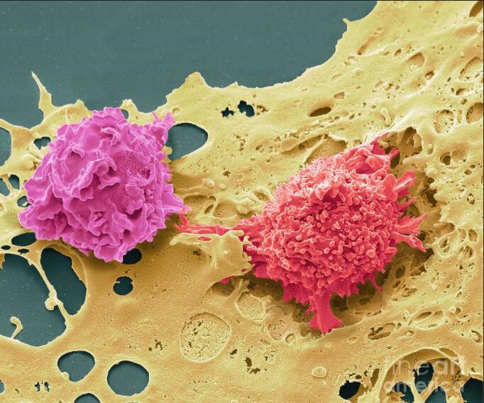 Mol Cancer|肿瘤外泌体和自然杀伤细胞功能障碍：生物学作用、临床意义和免疫治疗意义 - 知乎