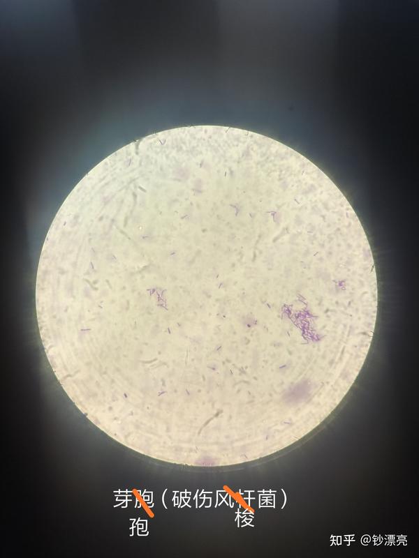 微生物显微镜🔬下观察 - 知乎