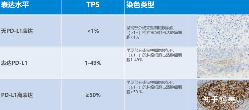 肺癌PD-L1判读和检测 - 知乎