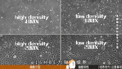 16HBE培养，人支气管上皮细胞培养攻略 - 丰晖生物 - 知乎