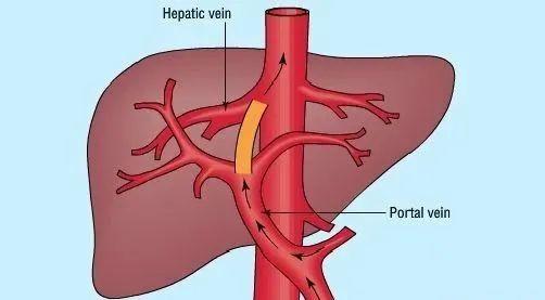 胃静脉曲张出血：TIPS和BRTO，那个更具性价比？ - 知乎