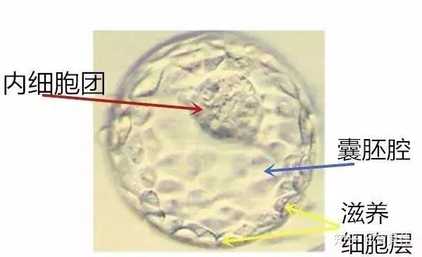 试管婴儿怎么算是优质囊胚，3aa、3ab、4ba？ 知乎