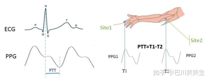 使用SVM从PPG回归BP - 知乎