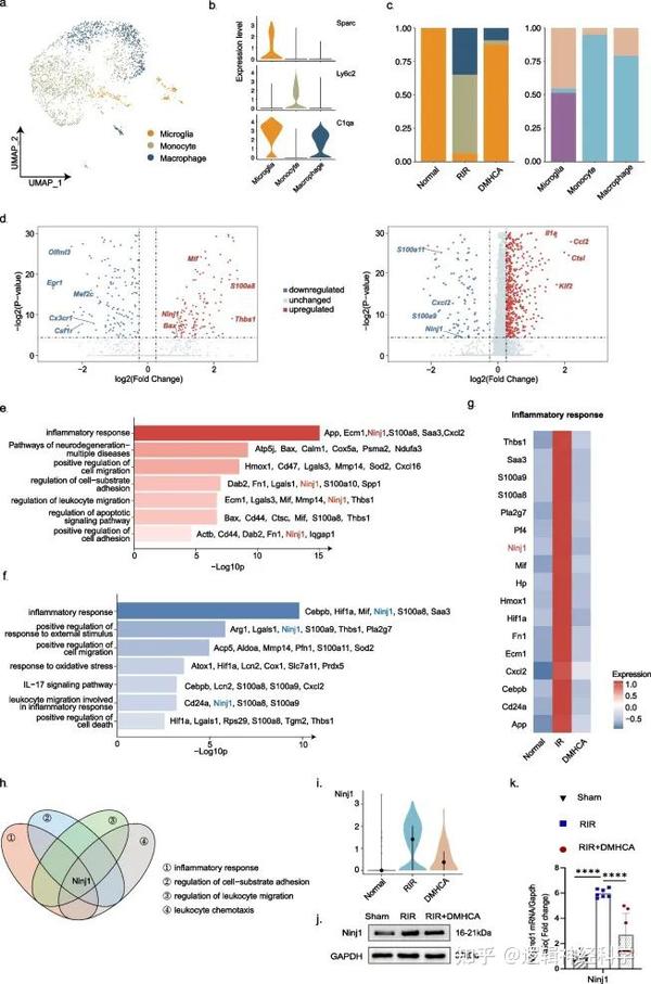 J Neuroinflammation︱中山大学卓业鸿/苏文如团队揭示DMHCA或可有效减轻视网膜缺血/再灌注损伤中神经元死亡和视网膜炎症 - 知乎