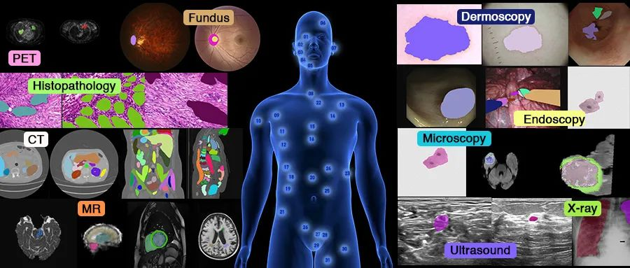 SAM-Med2D数据开源！超大规模医学分割数据集SA-Med2D-20M可下载 - 知乎