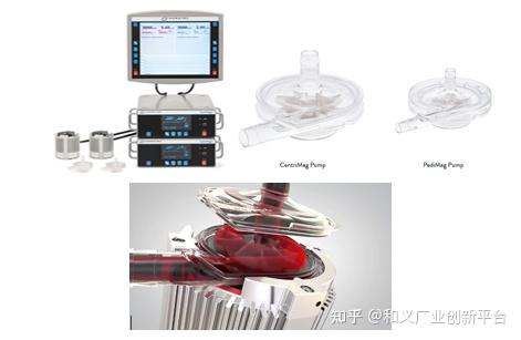人工心脏4——一文浅析短期PVAD（上） - 知乎