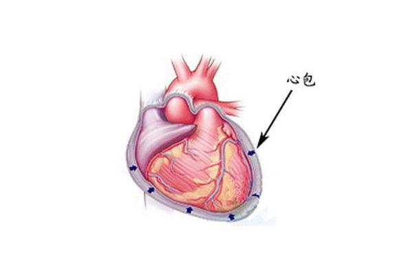 复发性心包炎疗法IL-1抑制剂Arcalyst（rilonacept）获FDA批准 - 知乎