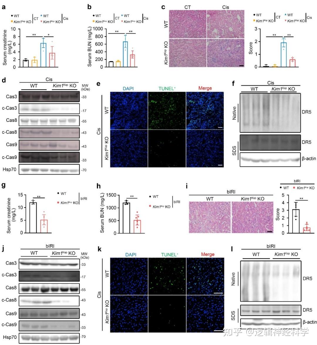 Nat Commun︱武汉大学郑凌/华中科技大学黄昆课题组联合发现肾脏YY1-KIM1-DR5轴调控急性肾损伤进展 - 知乎