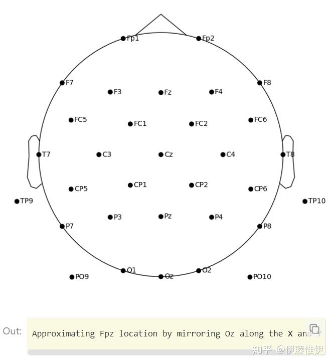 introductory——sensor locations - 知乎