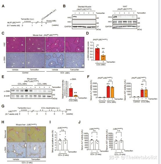 Cell Metabolism ：尊嘟假嘟，组蛋白乳酸化促进肝纤维化？ - 知乎