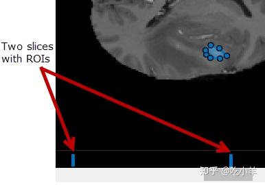 MATLAB图像处理：90：使用 Volume Segmenter 创建二进制蒙版 - 知乎
