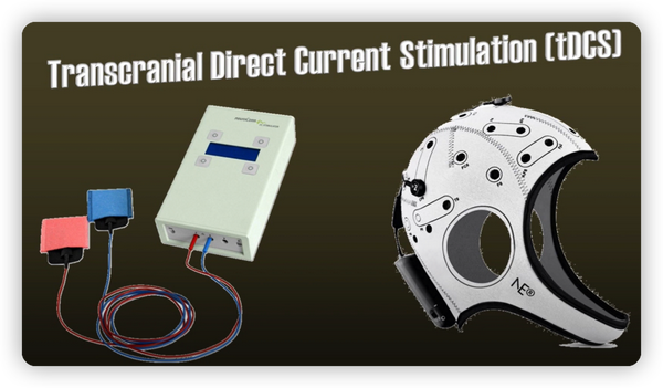 经颅电刺激（tES）技术 - 知乎
