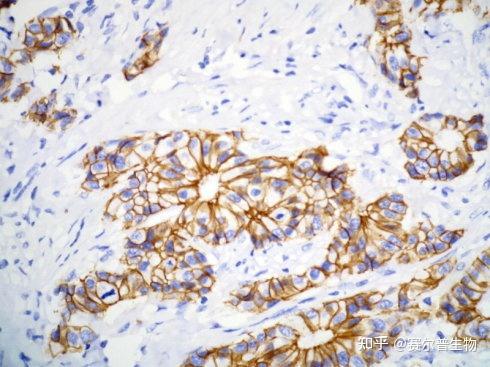 WB？IHC？ELISA？如何挑选更合适的免疫学工具？ - 知乎