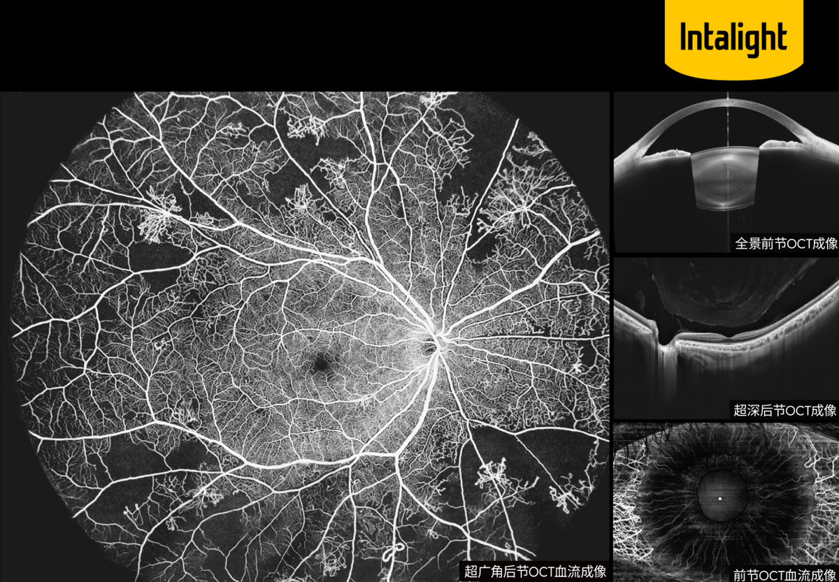 Intalight赛炜斩获MedTech全球最佳眼底影像设备品牌 - 知乎