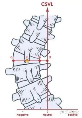 脊柱畸形角度测量 - 知乎