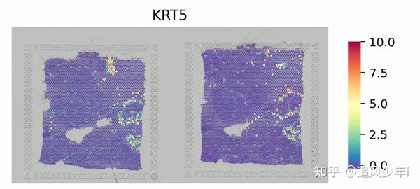 10X空间转录组分析之stlearn联合harmony整合多个空间样本 - 知乎