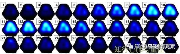 第139期胸部电阻抗断层成像（EIT）的原理、图像分析及临床应用 - 知乎