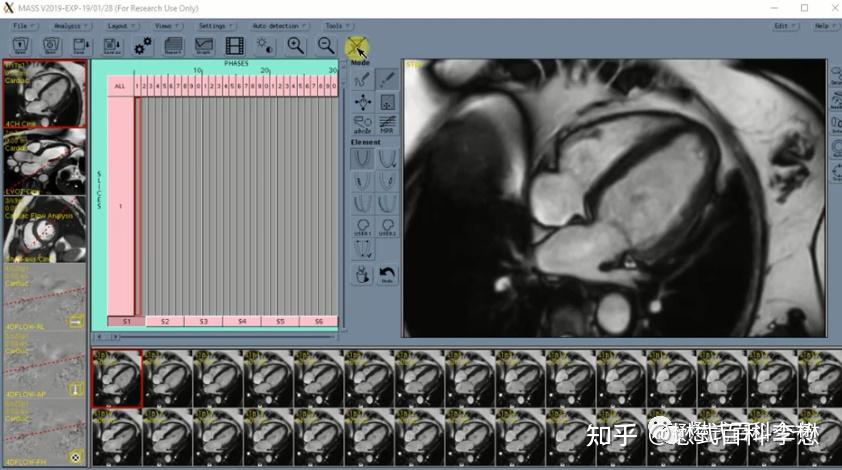 4D-Flow扫描数据采集：序列及参数 - 知乎