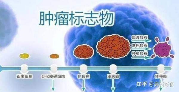 常见17种常用的肿瘤标志物【西安高尚健康体检】 - 知乎