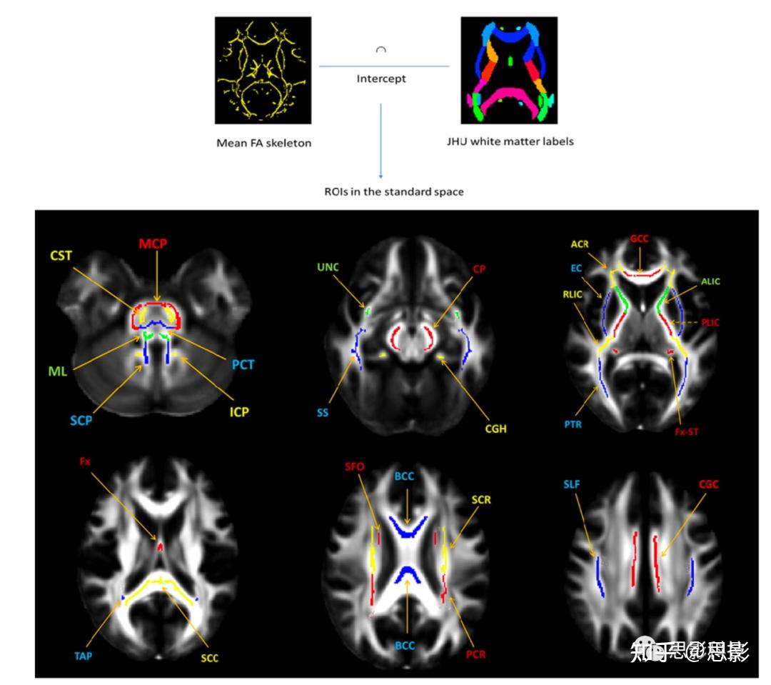 中青年人脑白质的年龄效应和性别差异：DTI、NODDI 和 q 空间研究 - 知乎