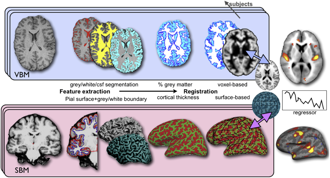 文献 | 如何利用现代神经成像技术研究我们大脑的结构和功能？ - 知乎