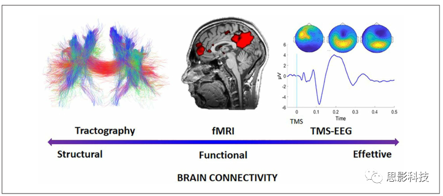 The Neuroscientist：整合TMS、EEG和MRI——研究大脑连接性的时空动态方法 - 知乎