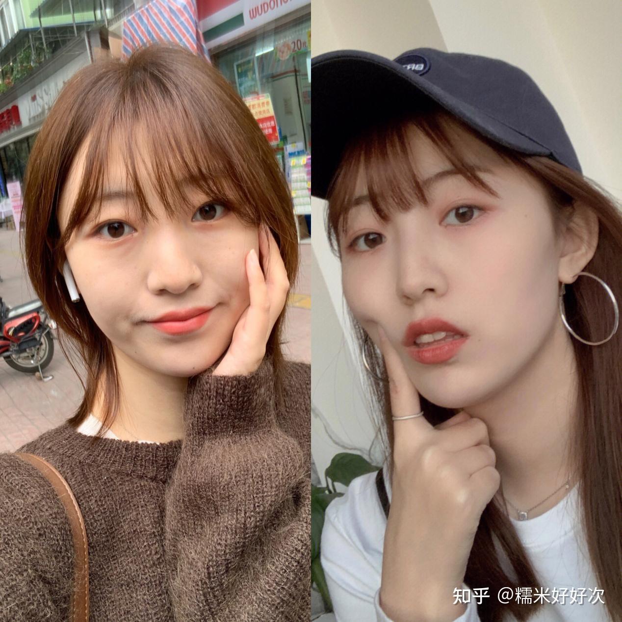 过了25岁,长期熬夜导致的垮脸,还有办法恢复回来吗,垮脸修复经验分享