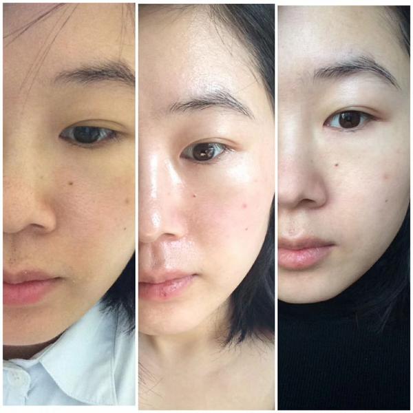 胶原蛋白美白调整皮肤之谜 知乎