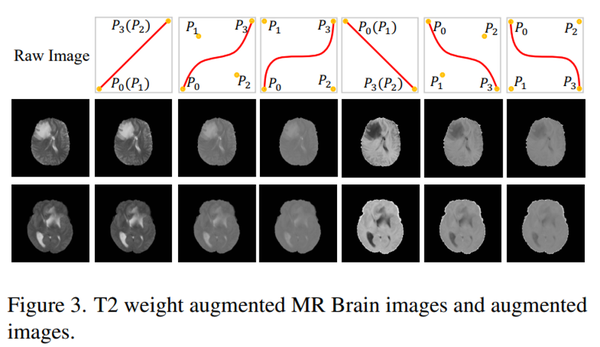 论文笔记21：Generalizable Cross-modality Medical Image Segmentation via Style Augmentation and Dual ...