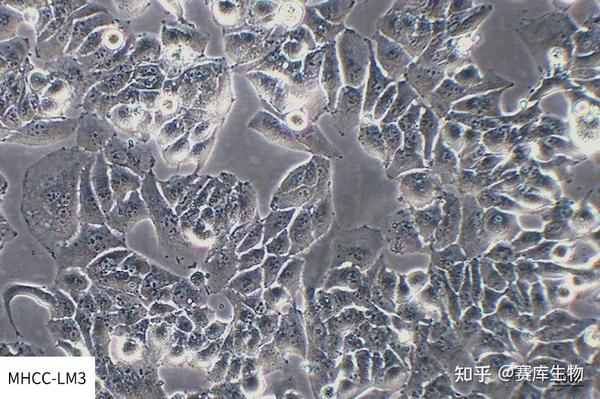 细胞学堂|人肝癌细胞系 - 知乎