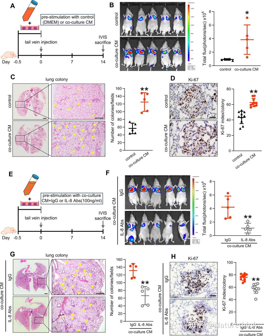 源自骨肉瘤与肿瘤相关巨噬细胞相互作用的 IL-8 通过粘着斑激酶通路在骨肉瘤生长和转移中的关键作用 - 知乎