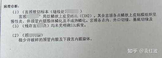 宫颈cin Ii能够理赔原位癌吗? 知乎