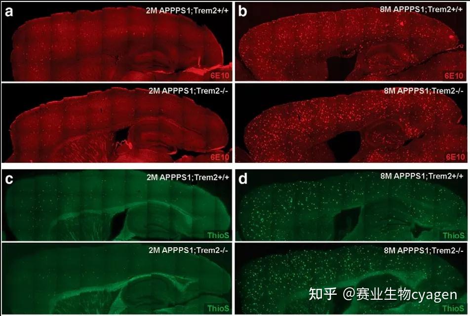 AD、代谢综合征和癌症的关键信号中心—Trem2 - 知乎