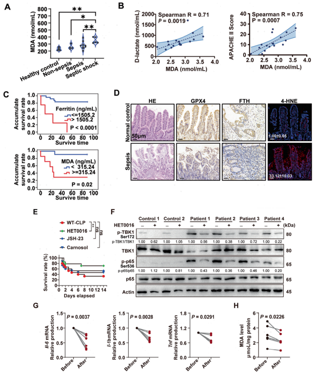 项目文章 | 单细胞测序揭秘STING与NCOA4相互作用关系并发现脓毒症的潜在治疗策略 - 知乎