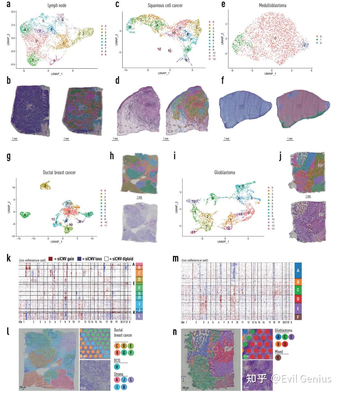 利用空间转录组学揭示良性和恶性组织中的细胞拷贝数变异 - 知乎