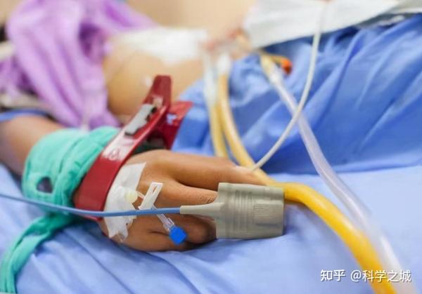 18天花掉113万，ICU到底是治病救人，还是“捞钱工具”？凭啥这么贵 - 知乎